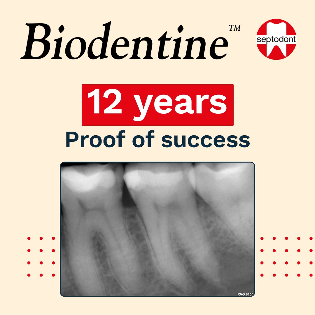Indirect Pulp Capping - Dr Sabbagh - Septodont UK